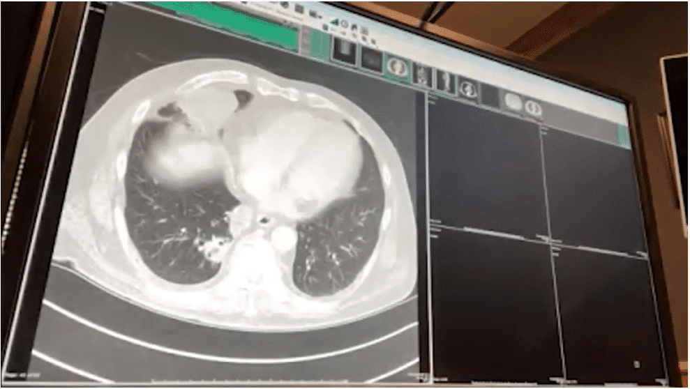 Dr. Wood discusses CT scanning at ARA - ARA Diagnostic Imaging